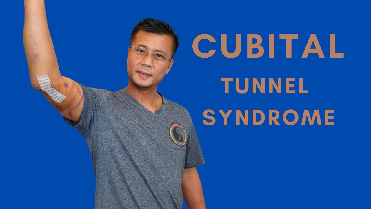 CUBITAL TUNNEL SYNDROME (Ulnar nerve compression) | Before and after ...