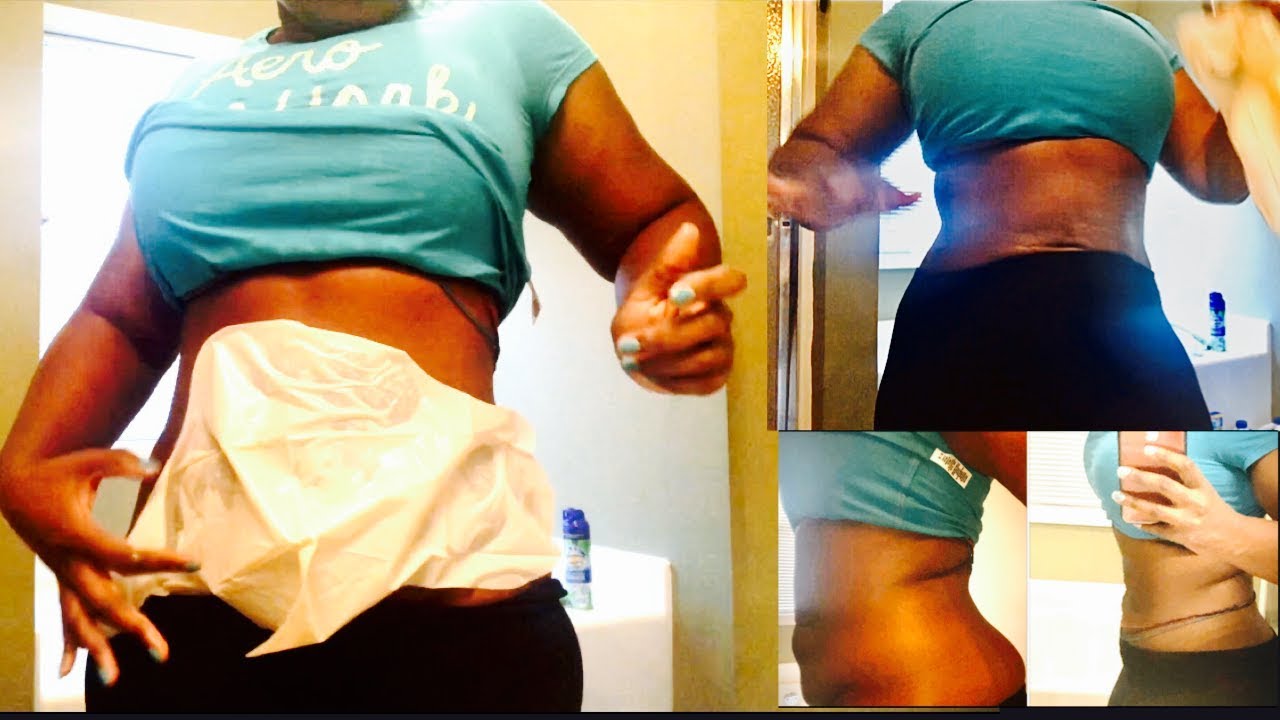 Body Wrap (Before And After) | Tone Tighten Belly POST CESAREAN SECTION ...