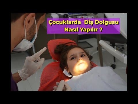 Çocuklarda Diş Dolgusu Nasıl Yapılır ? // How Is Tooth Filling Done In Children?
