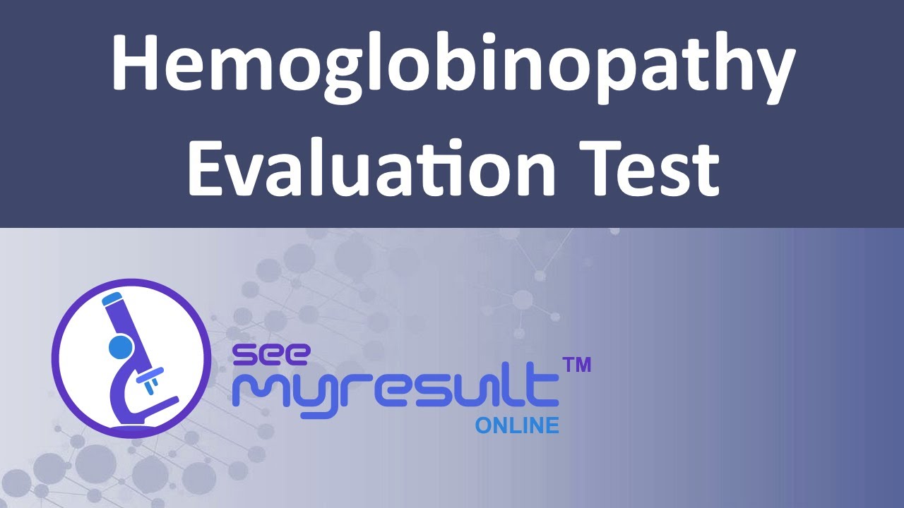 Hemoglobinopathy Evaluation Test - YouTube