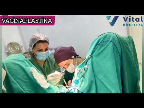 Vaginaplastika (uşaqlıq yolunun daraldılması). Op.Dr.Nigar Məcidova 050-312-23-12