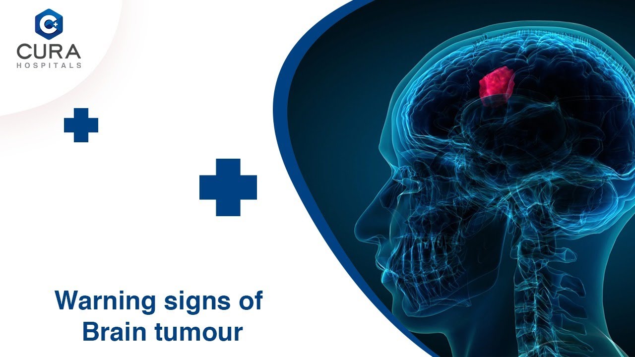 Warning Signs of Brain Tumor | #WorldBrainTumorDay2020 - Cura Hospitals ...