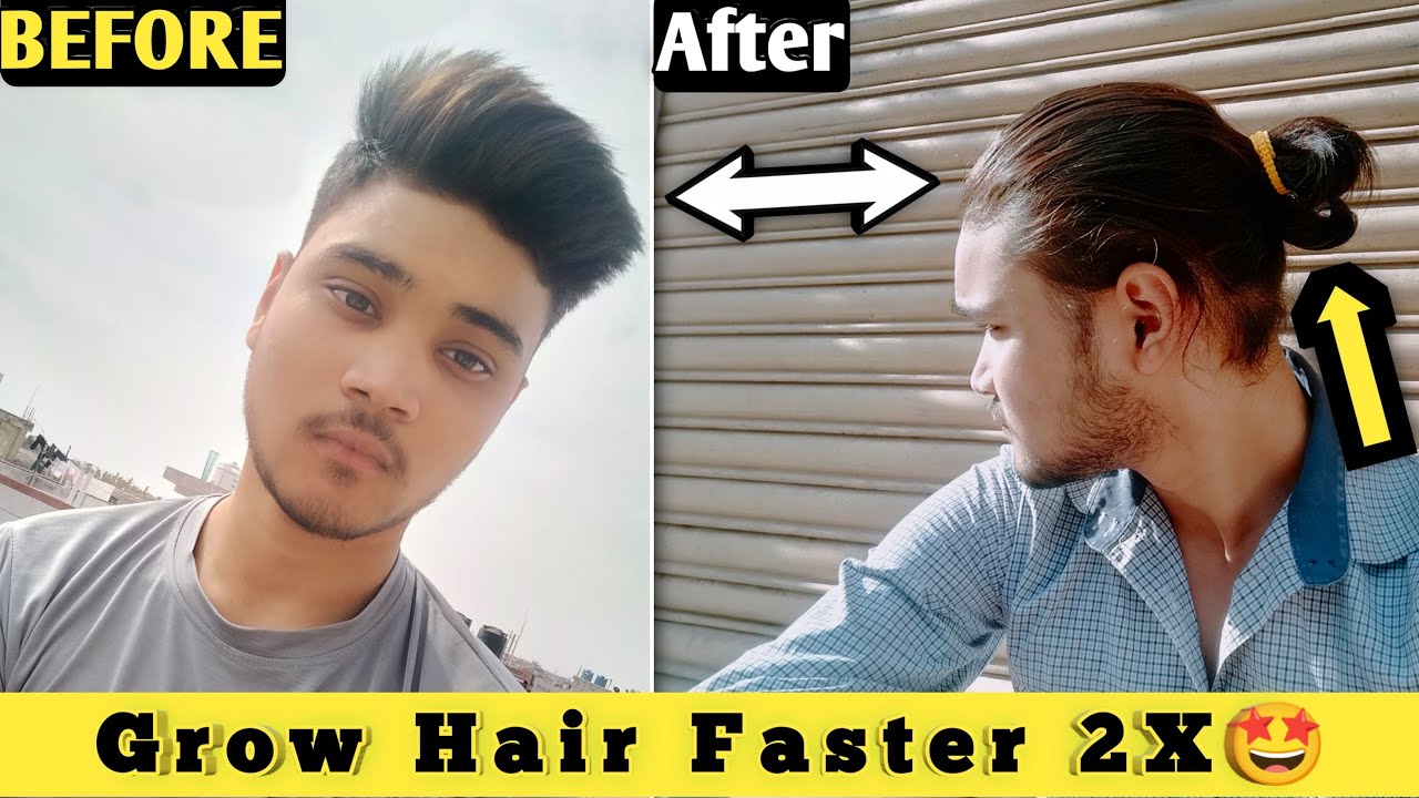 How To Grow Hair Faster | Hair Growth Tips For Men | Naturally हिंदी ...