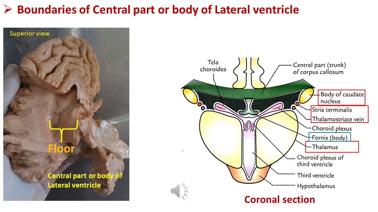 1. Lateral ventricles of brain PART 1 - YouTube