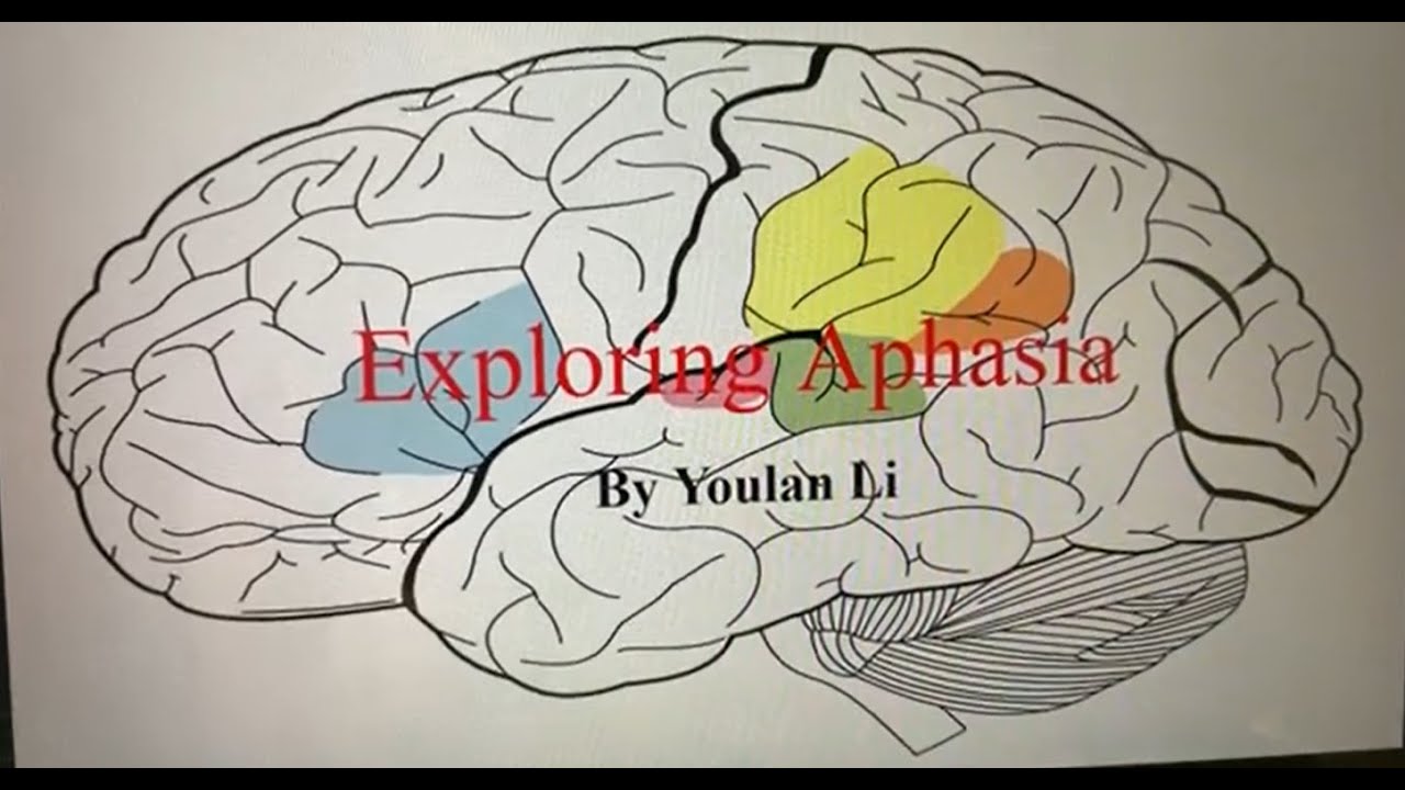 Exploring Aphasia: Understanding Language Challenges and Empowering ...