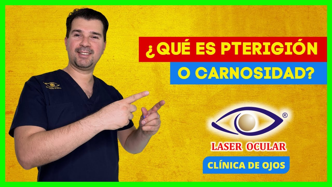 🥇 ¿Tienes Pterigión o Carnosidad? | LÁSER OCULAR - Clínica de Ojos - Dr ...
