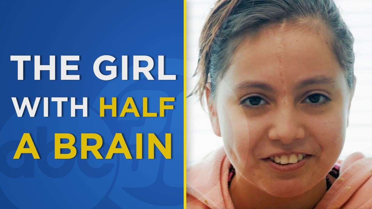 How a Valley teen is living with half a brain - YouTube