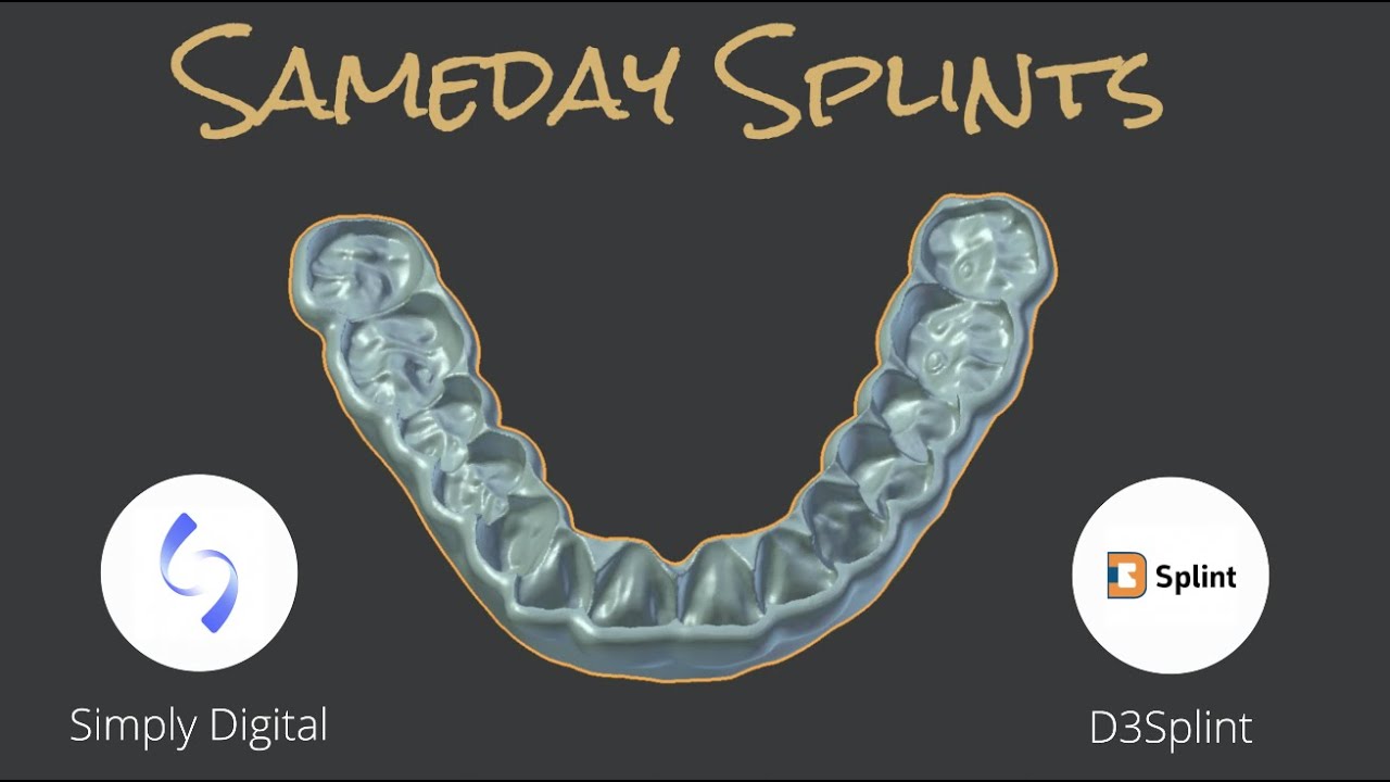 Sameday Splints workflow tutorial using D3Splint for CAD design, 3D printing and post-processing ...