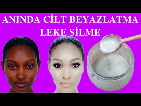 | Evde yüz cilt beyazlatma / Daha temiz, temiz ve kalıcı olarak lekesiz bir cilt elde edin