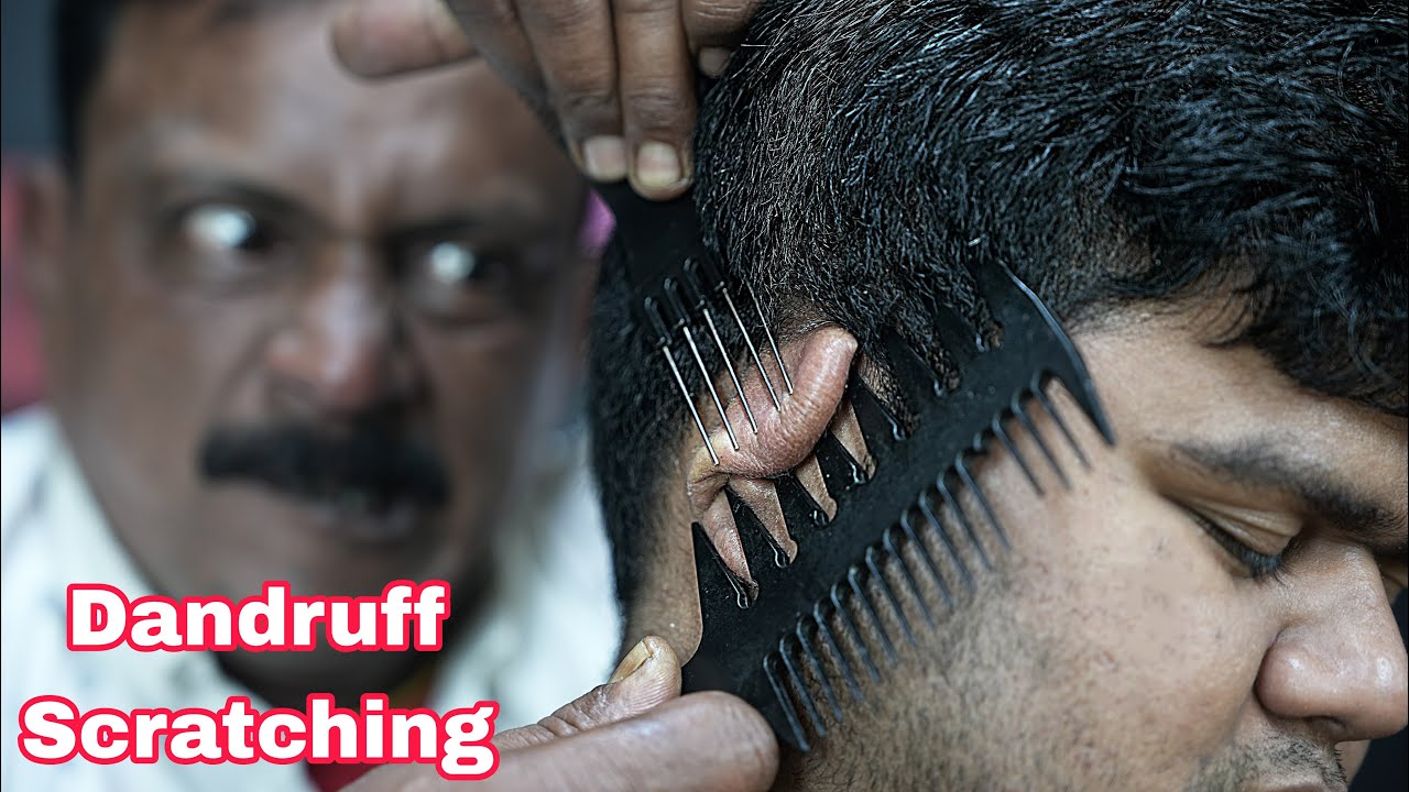 Dandruff Sculp Scratching With Comb | ASMR 3d Sound | Big Eyes Barber ...