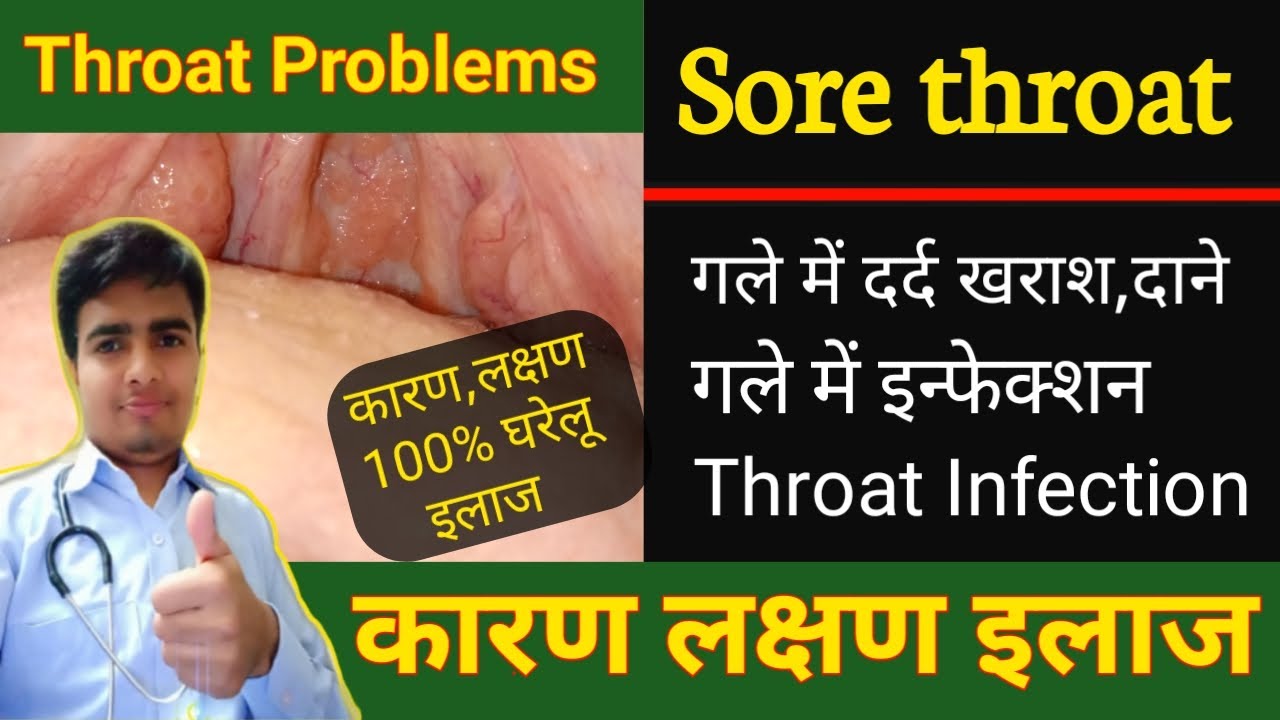 Sore throat,गले में दर्द,गला सूखना,गले का इन्फेक्शन कारण लक्षण, gale me ...