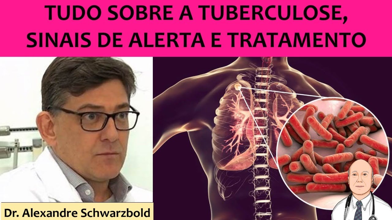 Tuberculose pode ser letal: sintomas, sinais de alerta, diagnóstico e ...