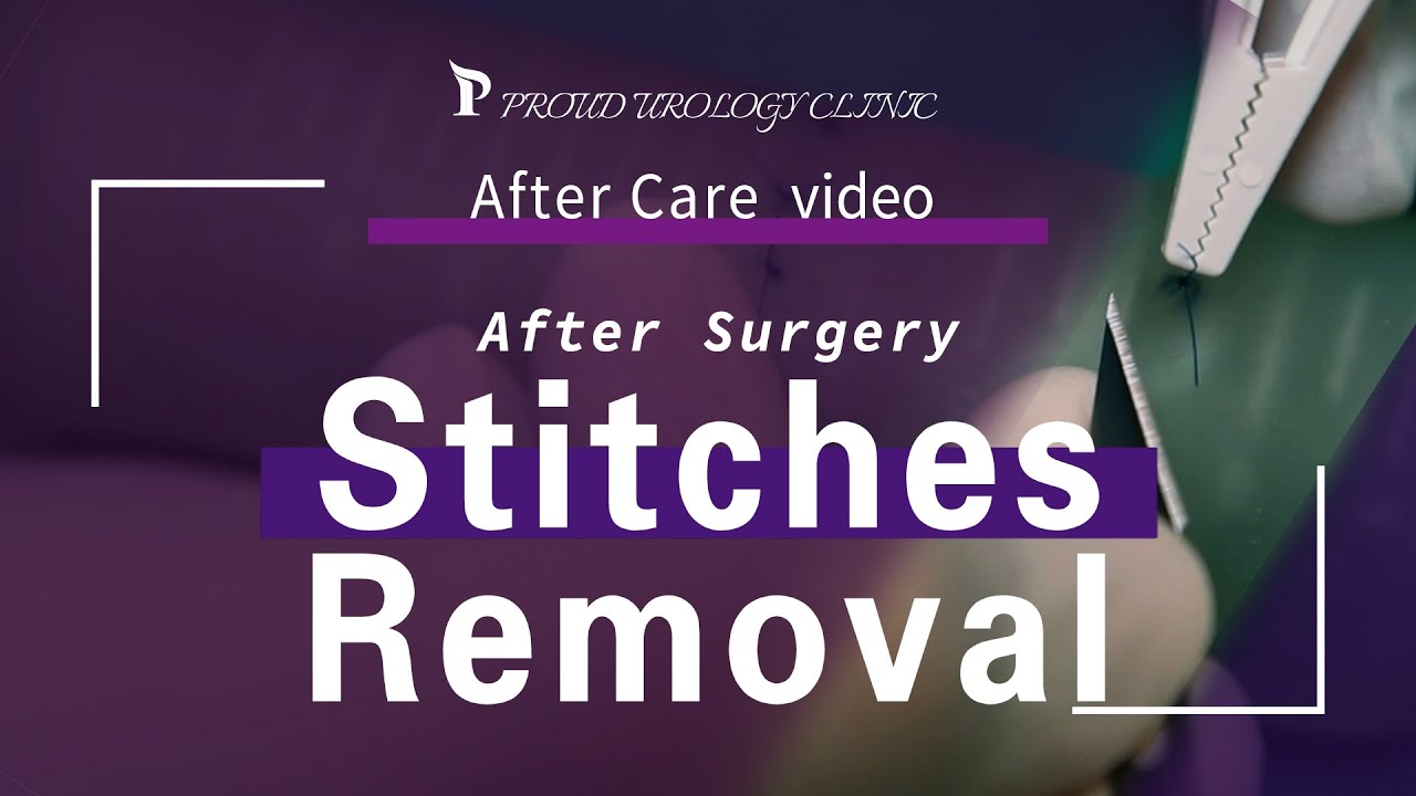 stitches Removal after surgery - YouTube