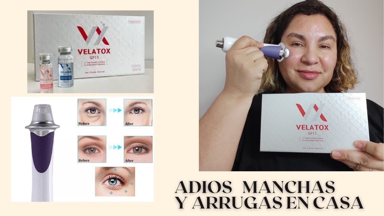 VELATOX TRATAMIENTO MANCHAS FACIALES, ARRUGAS y más en casa fácil y ...