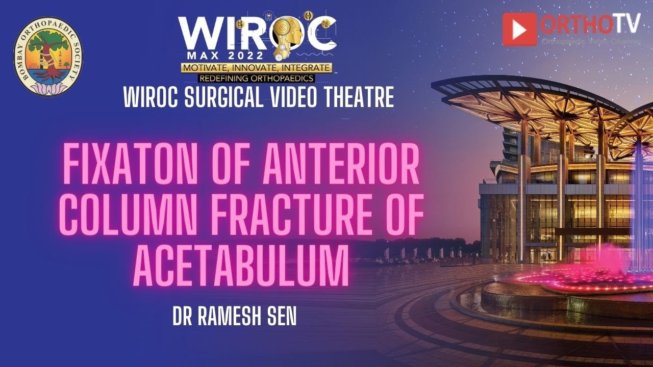 Anterior column fixation using AIP approach Dr Ramesh Sen - YouTube