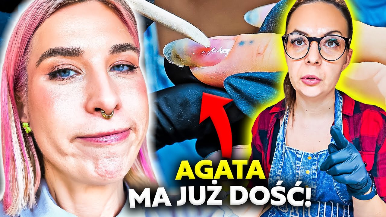 ♦ AGATA RATUJE ZNISZCZONE PAZNOKCIE! CZEGO UNIKAĆ, A CO TRZEBA ROBIĆ? ♦ ...