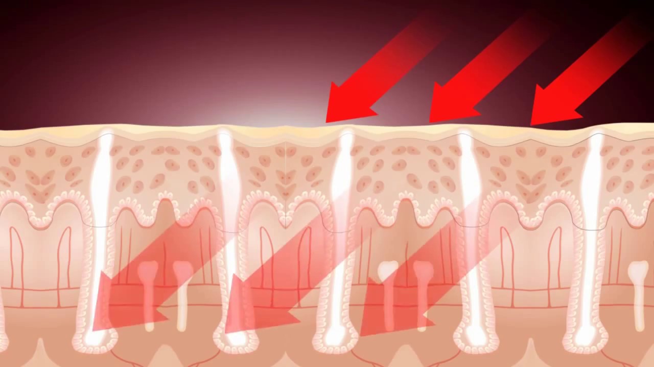 2d animation sunscreen - YouTube