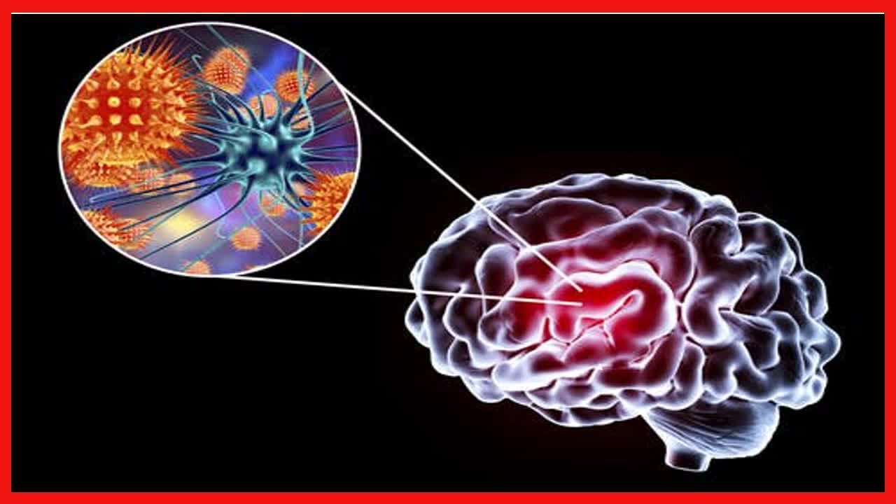 Encéphalite : symptômes, causes et traitement - YouTube