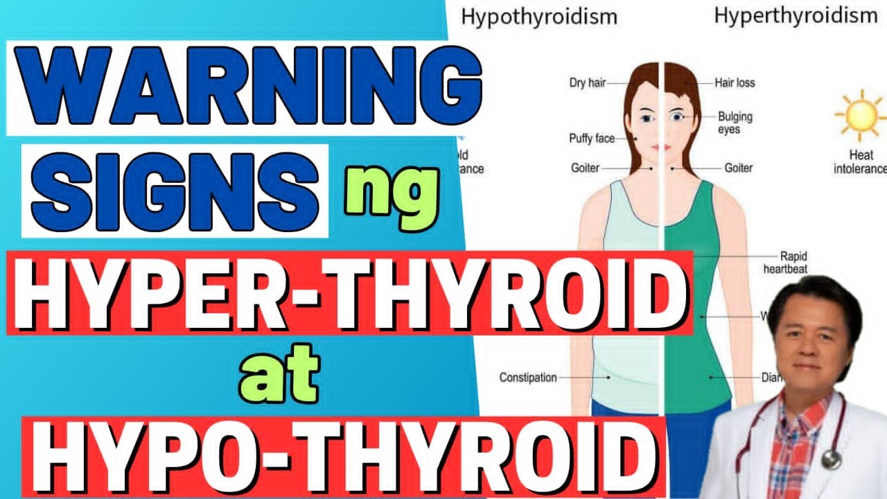 Warning Signs ng Hyper-thyroid at Hypo-thyroid.by Doc Willie Ong ...