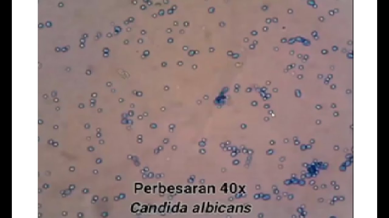 Video Praktikum Biomedik II Pertemuan ke-10 Pemeriksaan Khamir - YouTube