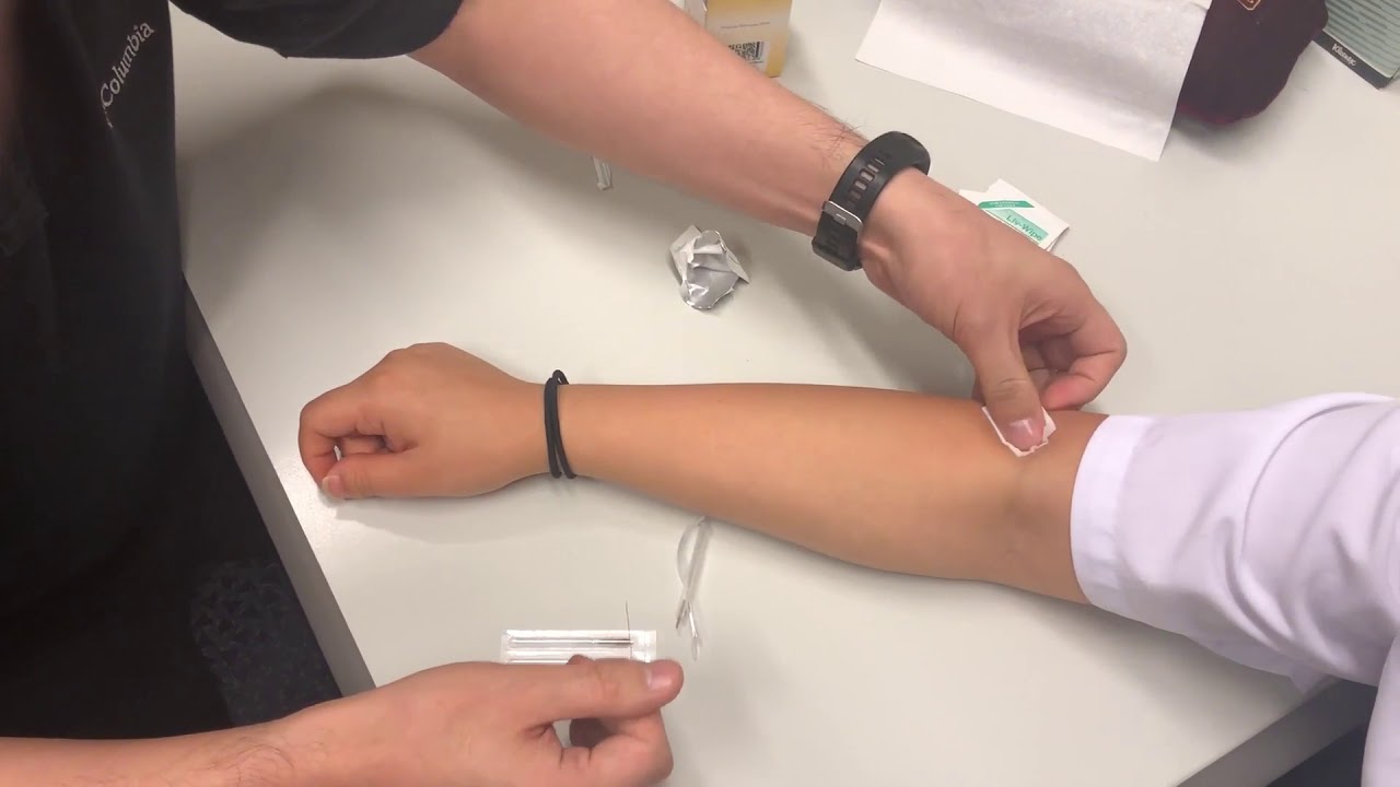 A Painless Needle Insertion - Acupuncture Flying Needle on LI11 - YouTube