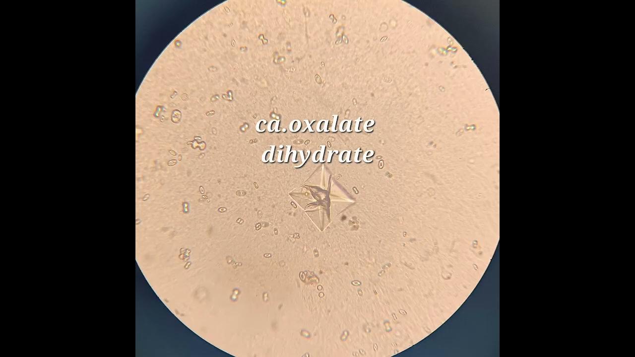 urine slides in microscope - YouTube