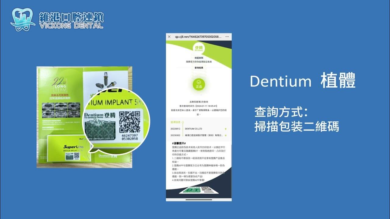 【深圳睇牙】北上種植牙擔心水貨？今日維港口腔就教大家點樣辨植體真偽！記得收藏！深圳植牙深圳牙科維港口腔深圳睇牙大陸種牙深圳種牙邊間好北上植牙北上睇牙種植牙推介維港口腔