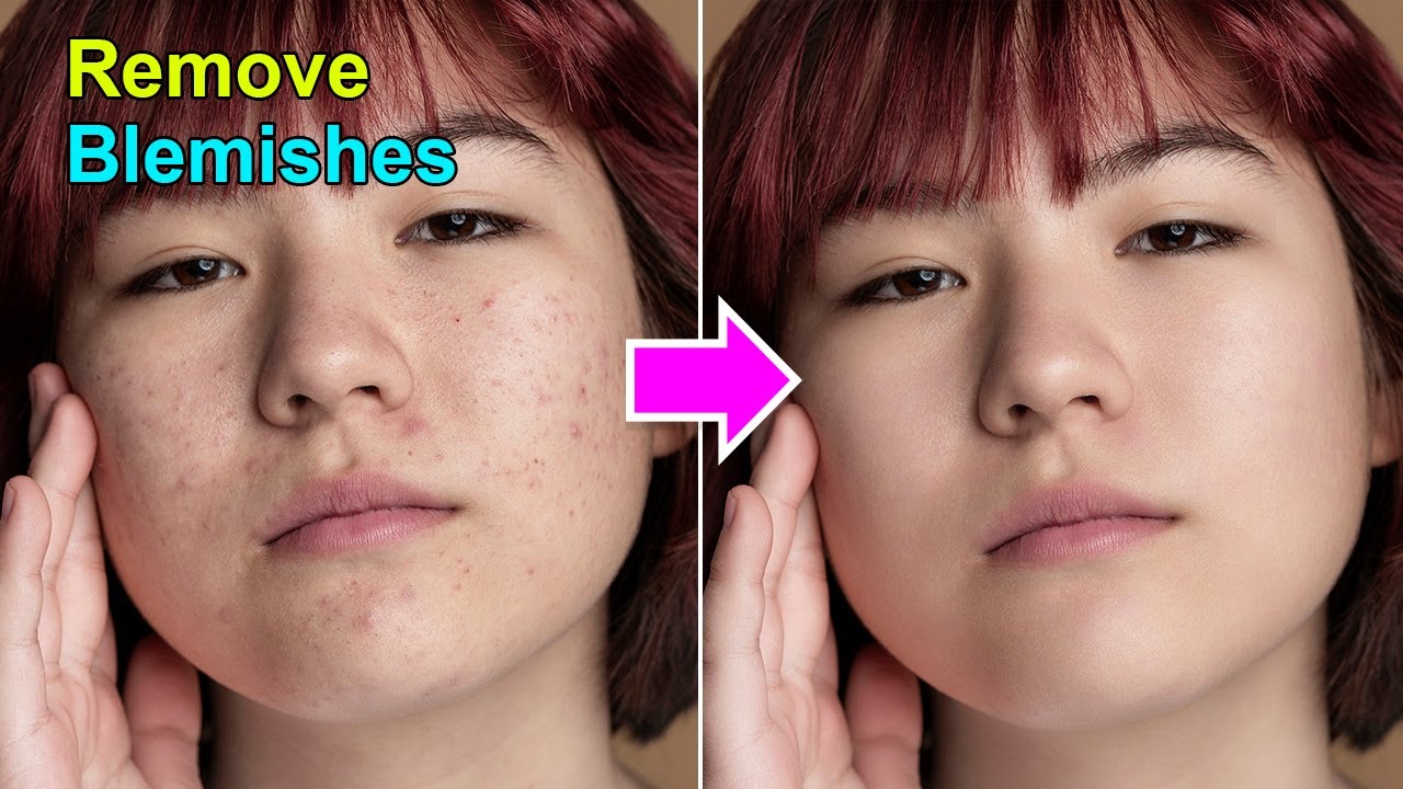 One Click to Remove Blemishes - YouTube