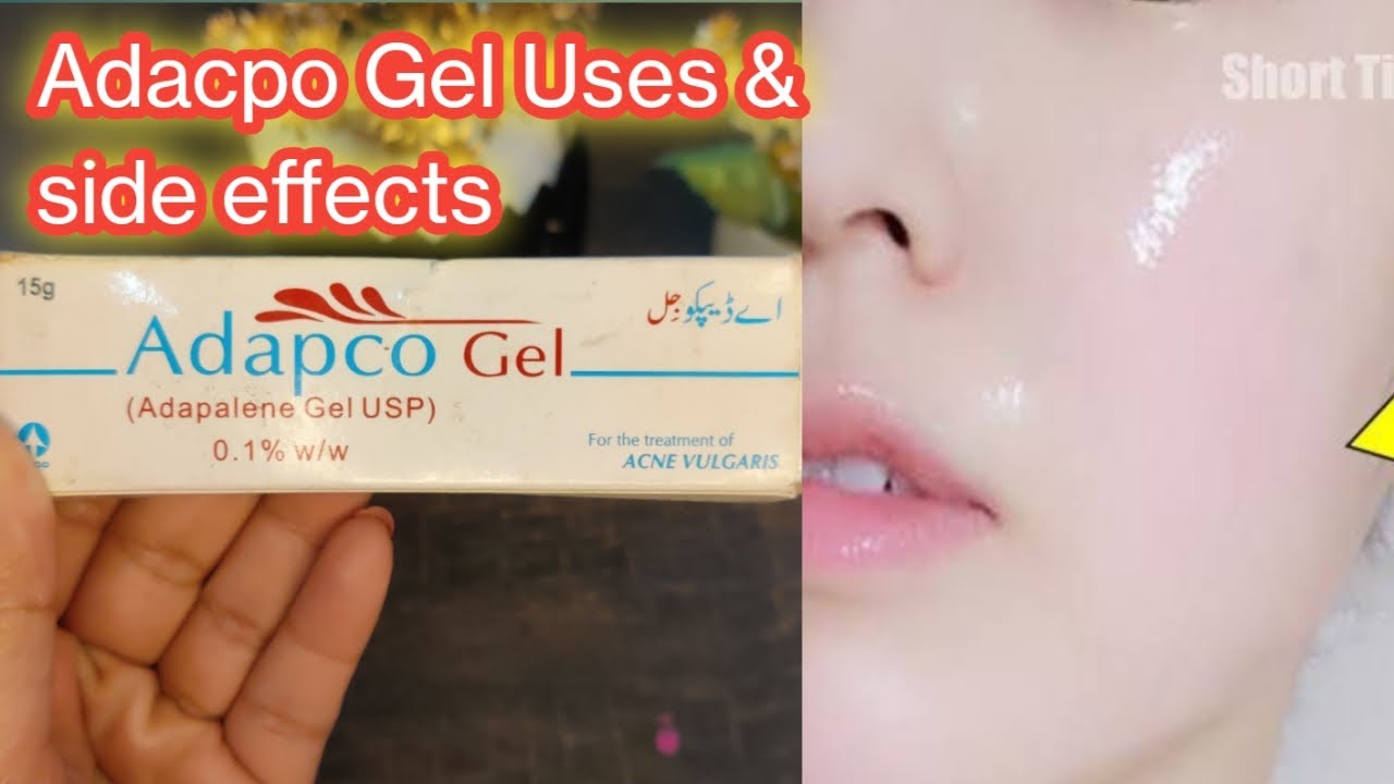 Adapco gel for acne |adacpo cream |Adapco gel |Adapalene gel |Remove ...
