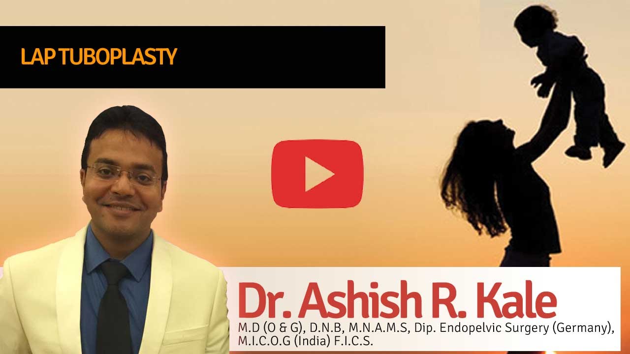 LAP TUBOPLASTY - YouTube