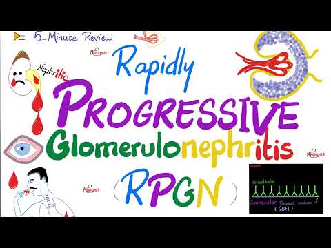 Rapidly Progressive Glomerulonephritis (RPGN) | Cresenteric | Nephritic Syndrome Subtypes