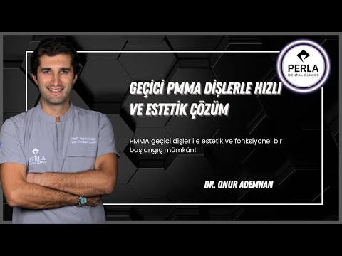 Aynı Gün Geçici Dişler ile Konforlu Başlangıç