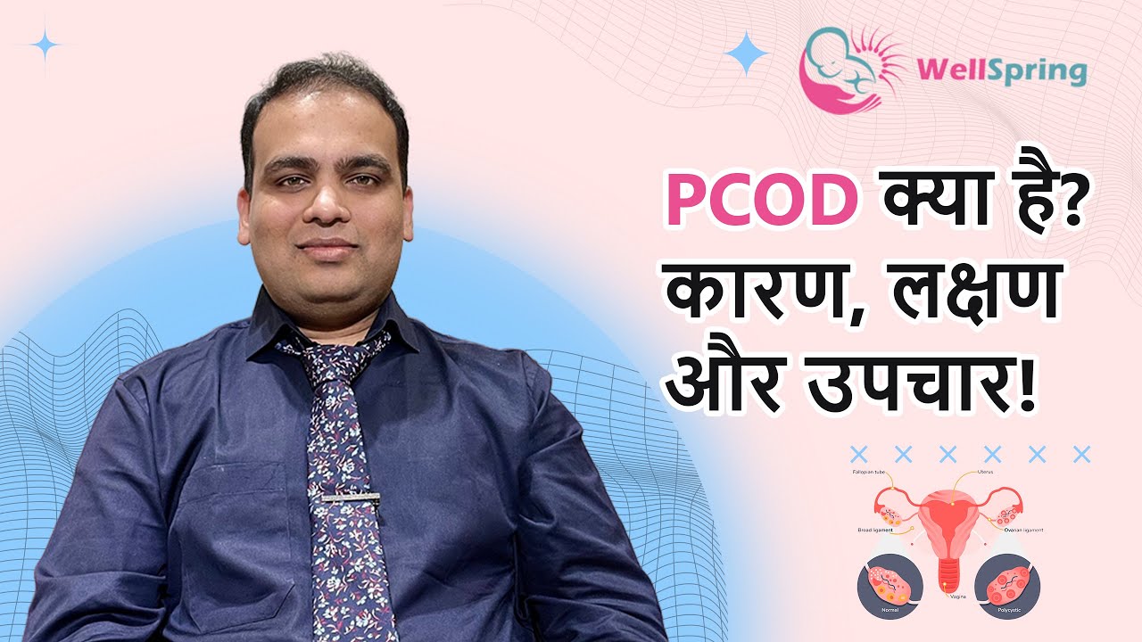 PCOD क्या है? कारण, लक्षण और उपचार! Understanding PCOS/PCOD: Causes ...