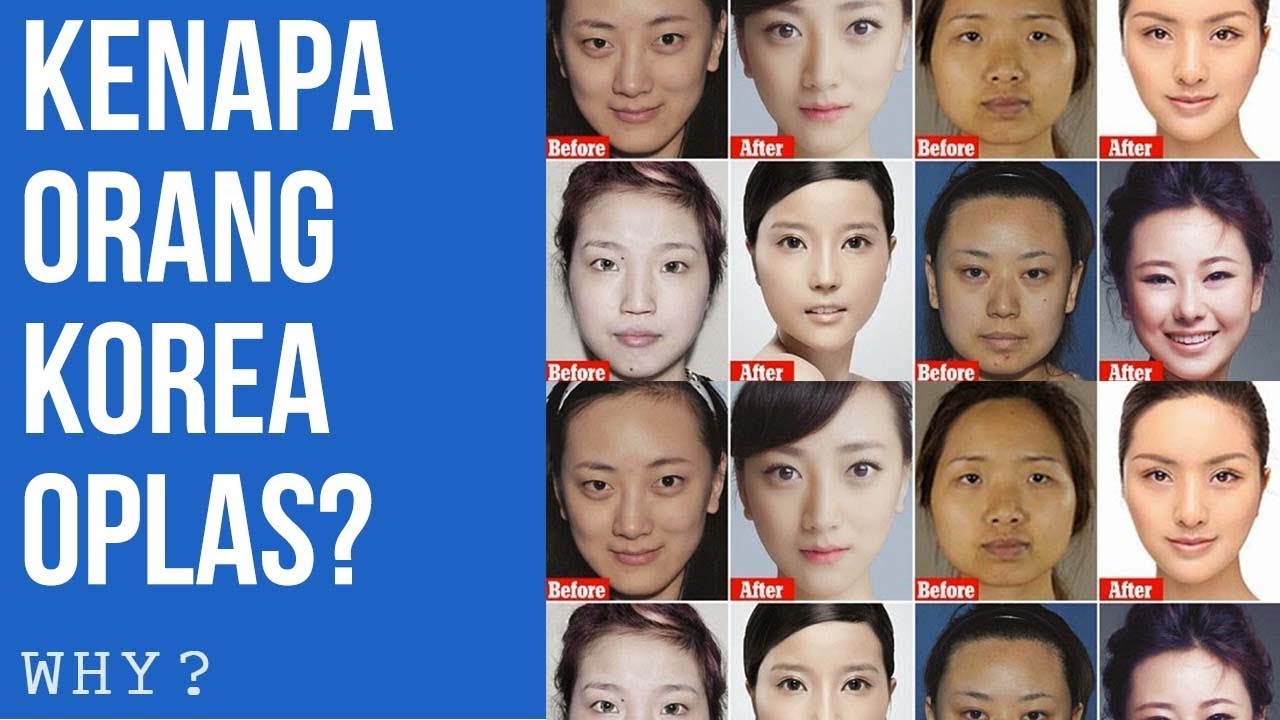 Kenapa orang Korea oplas? | WHY? - YouTube
