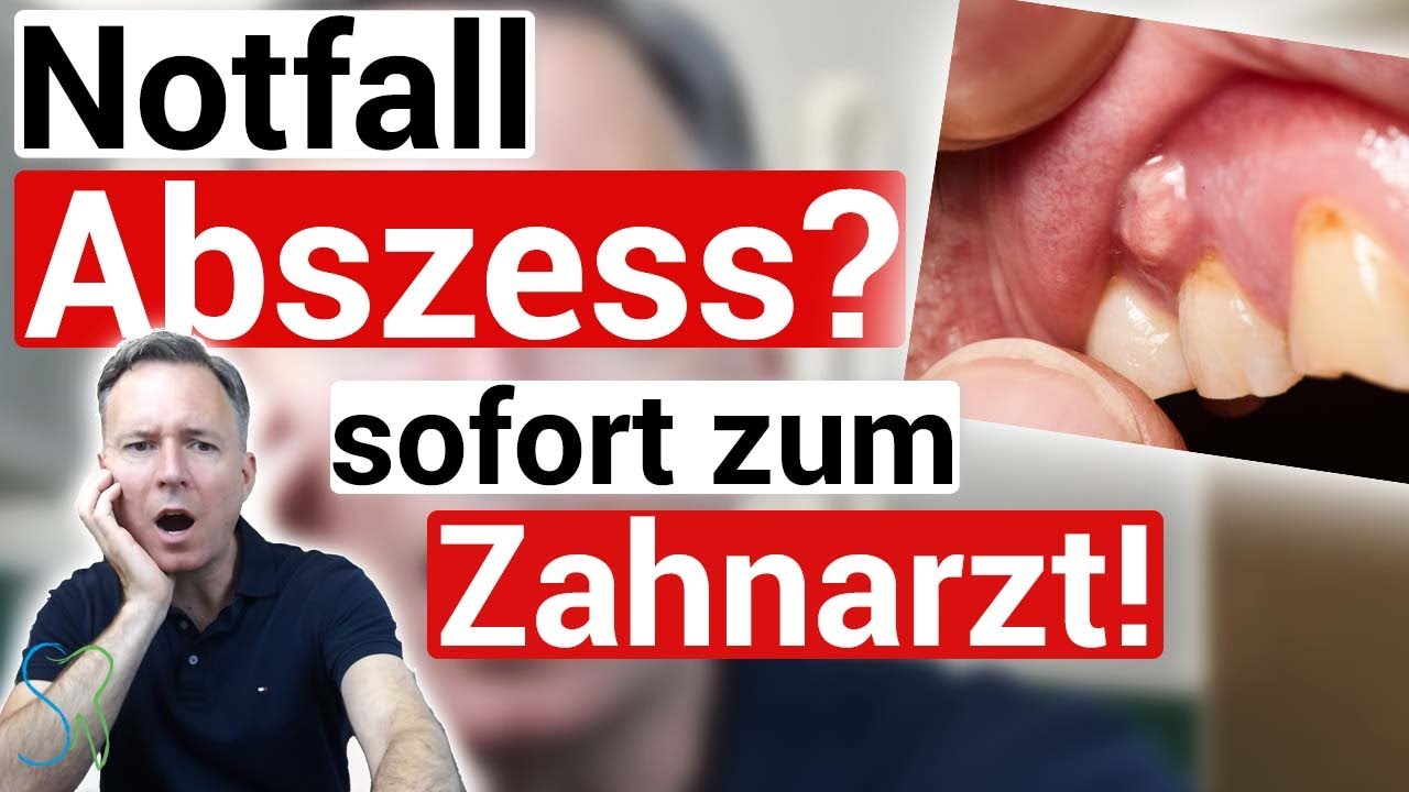 Achtung Notfall | Abszess | sofort zum Zahnarzt - YouTube