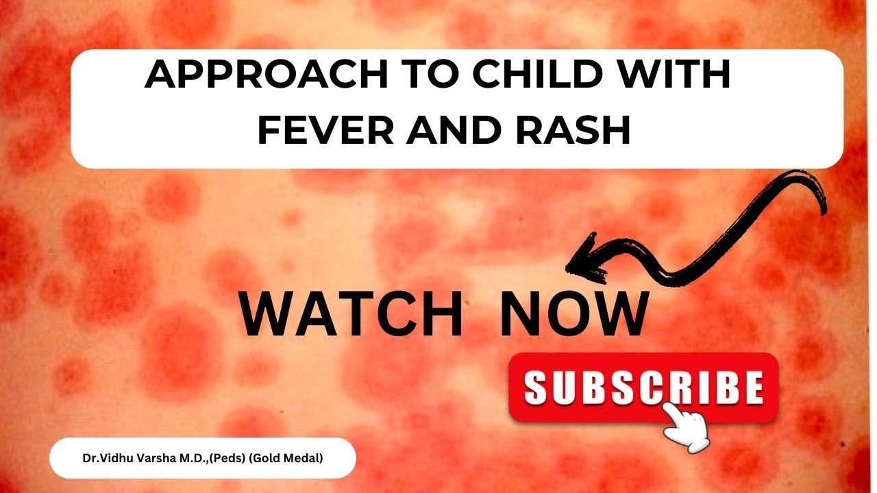 Approach to a child with Fever & Rash - YouTube