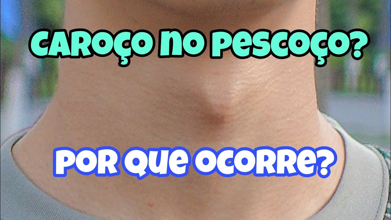 Por que alguns HOMENS possuem CAROÇO no PESCOÇO? #shorts - YouTube