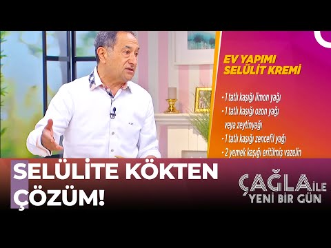 Selülitlerden Şikayetçiyseniz DİKKAT! - Çağla ile Yeni Bir Gün 837.Bölüm