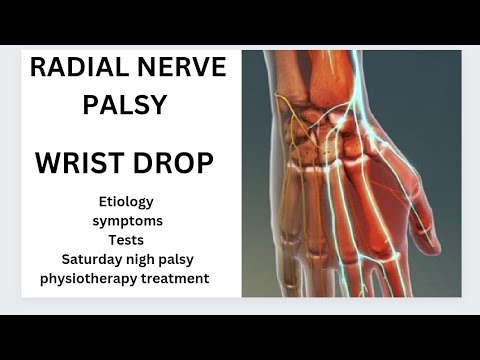 Radial nerve palsy(in Hindi)| Wrist drop |symptoms |Saturday night ...