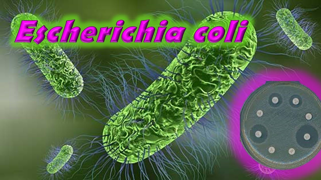 Escherichia coli y el Antibiograma - YouTube
