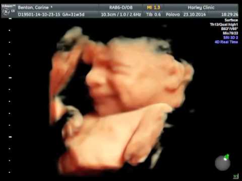 HD Live Scan - GrimaceDimplesSmile - YouTube