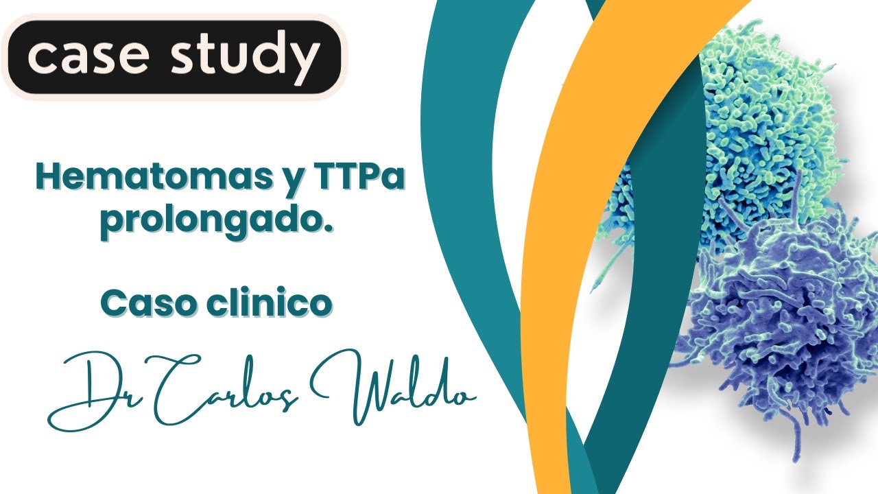 Hematomas y TTPa prolongado Caso clínico - YouTube