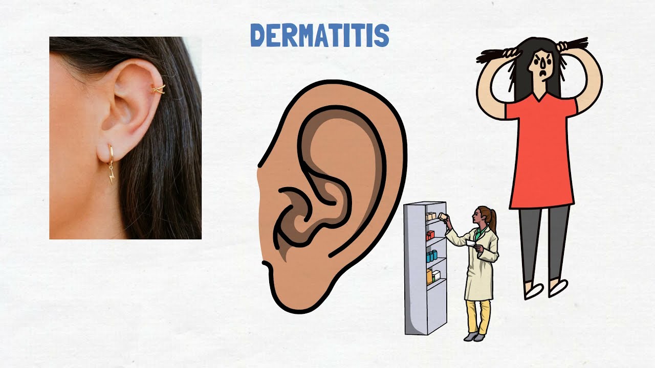DERMATITIS POR CONTACTO EN EL OÍDO - YouTube