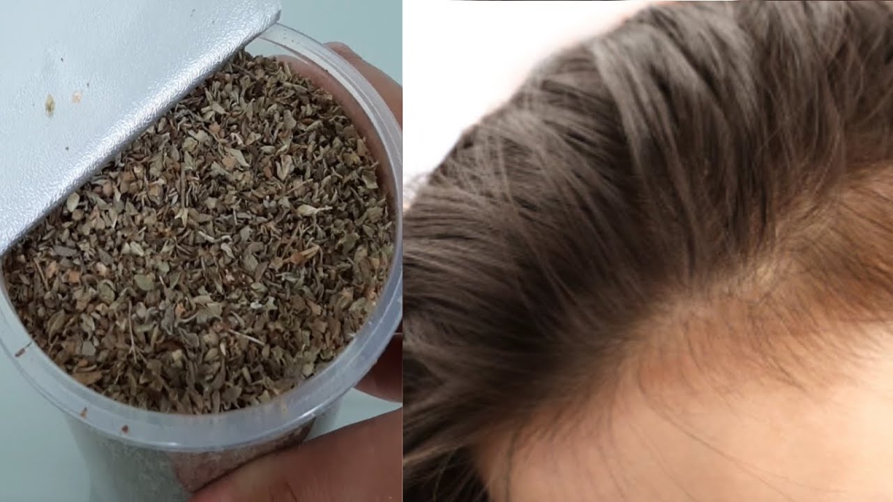 QUANDO PINGO ISSO MAIS NASCE CABELO ATÉ NA TESTA, ATÉ CARECA FICA ...