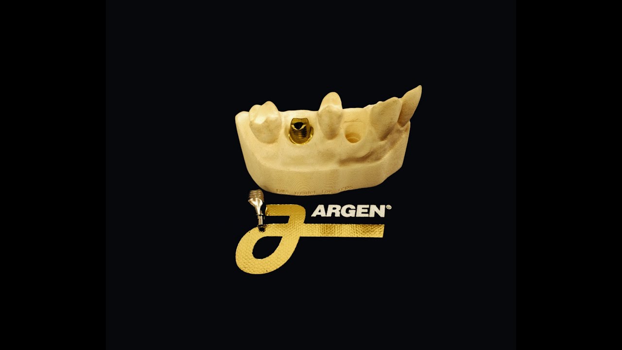 ADIM Argen Digital Implant Models with Ti Abutment - YouTube