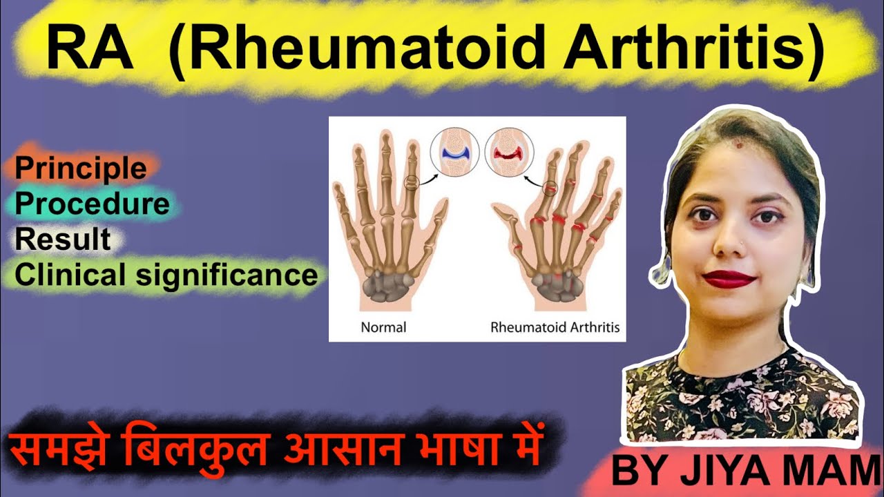 RA ( Rheumatoid Arthritis in Hindi ) in Hindi | RA test | RF factor ...