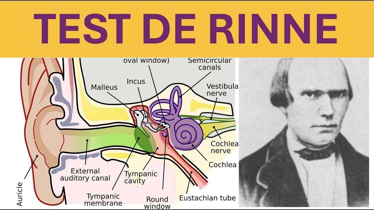 Test de Rinne - YouTube