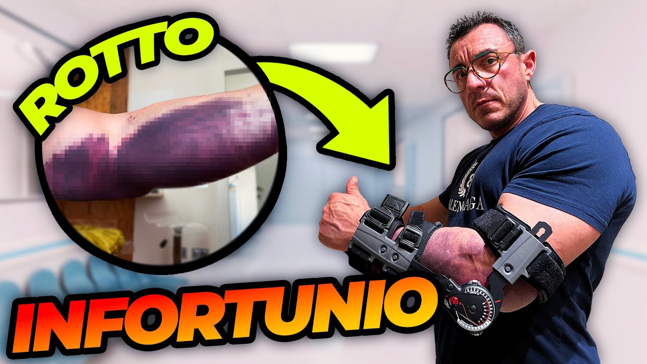 MI SONO INFORTUNATO - YouTube