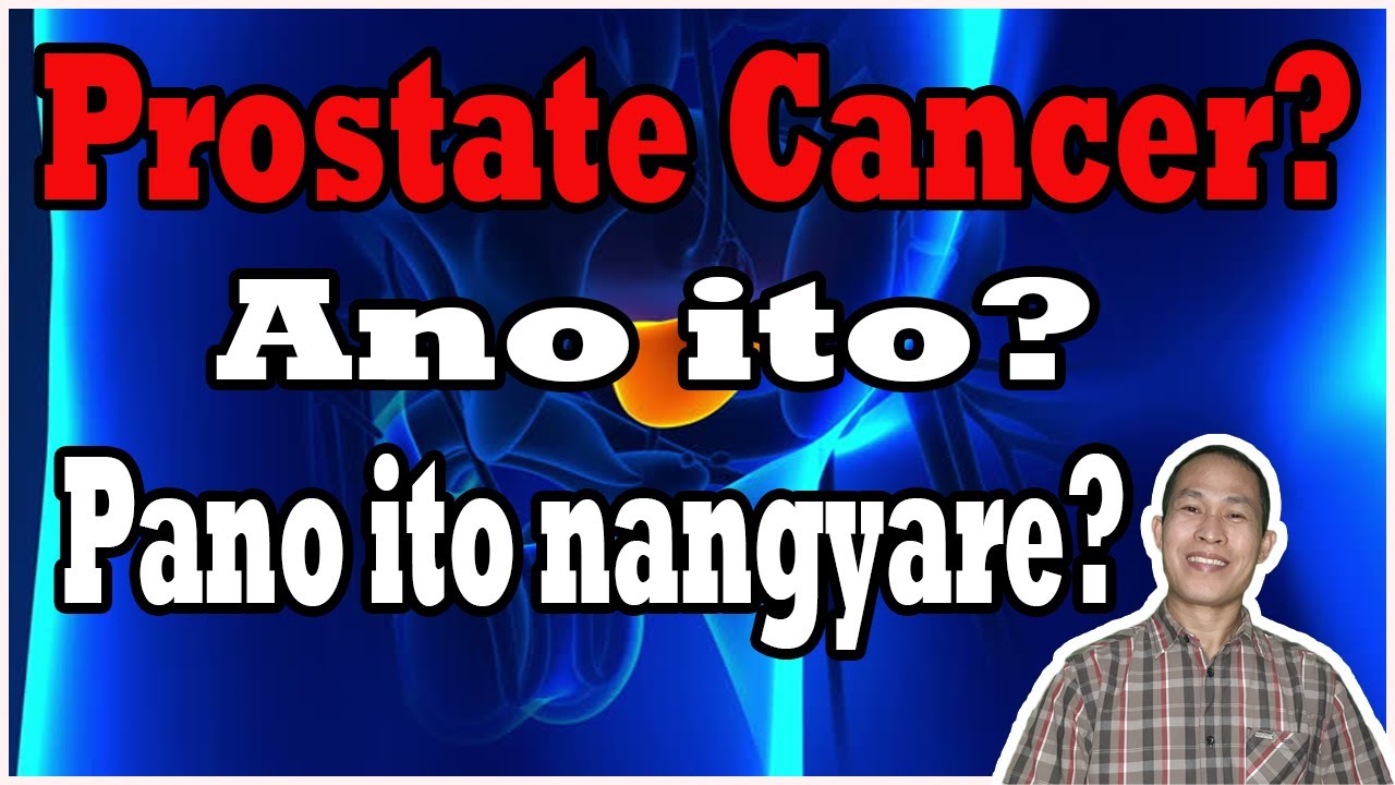 Prostate Cancer? Ano ito? Paano ito nag simula? - YouTube