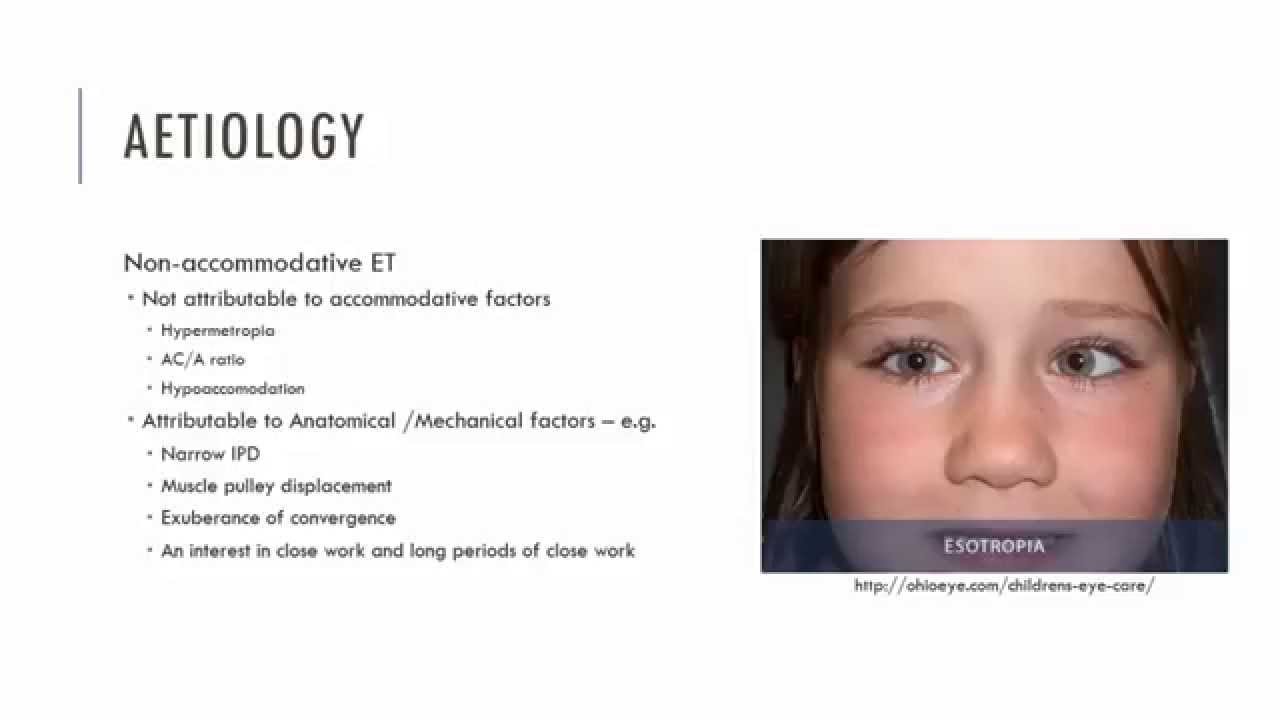 Non Accommodative ET Characteristics - YouTube